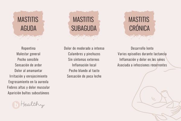 Mastitis: Qué es, qué síntomas tiene y por qué se produce